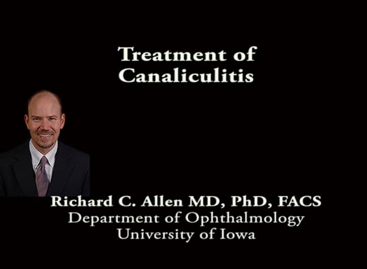 Treatment of Canaliculitis on Vimeo