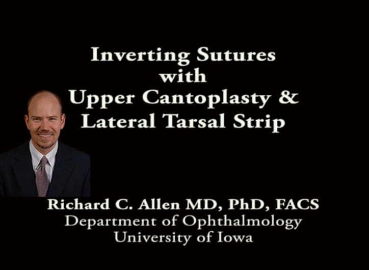Inverting Sutures with Upper Cantoplasty and Lateral Tarsal Strip on Vimeo
