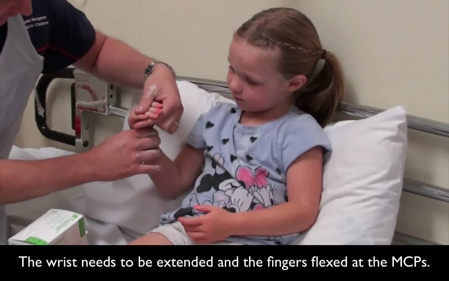 Volar/Ulnar Gutter backslab on Vimeo