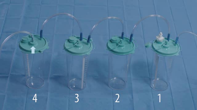 Thermedx® FluidSmart™ System In-Service on Vimeo