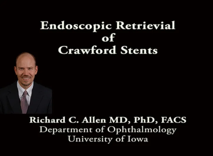 Endoscopic retrieval of Crawford stents on Vimeo