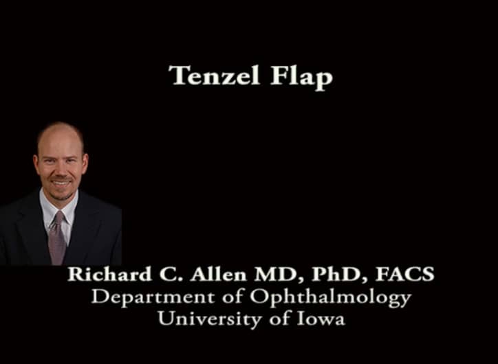 Tenzel flap on Vimeo