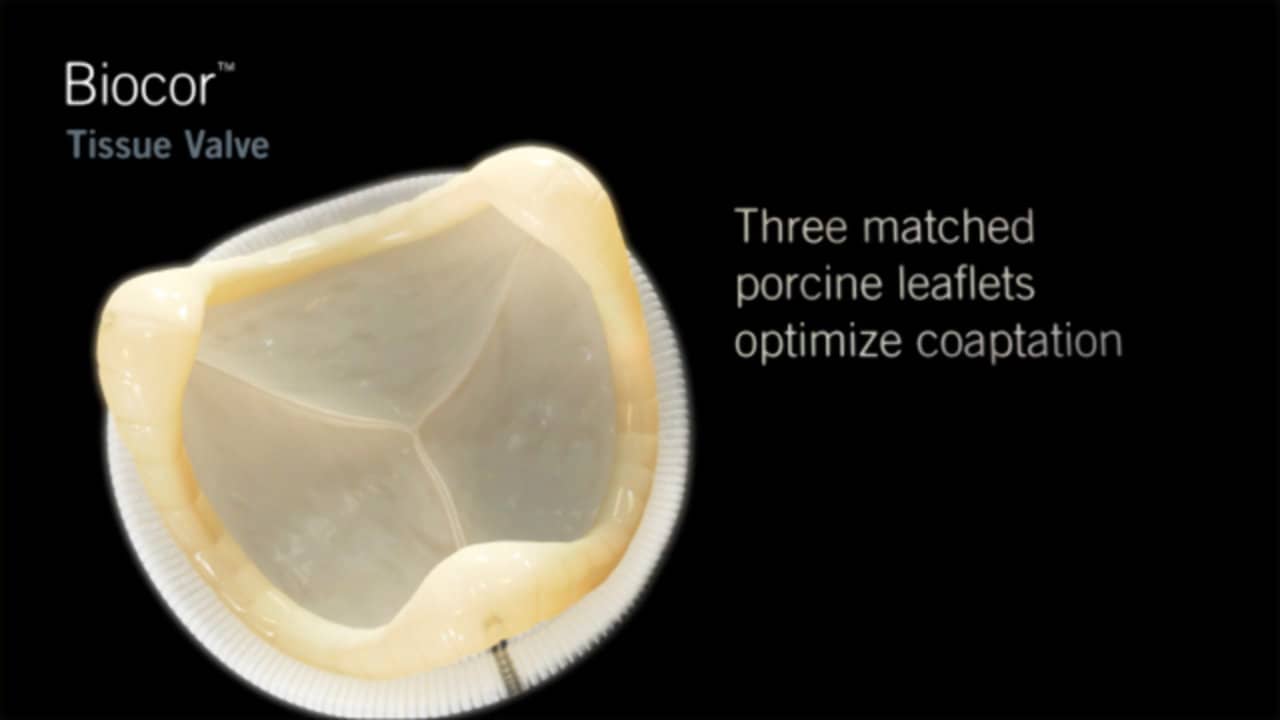 Biocor Valve Durability Animation on Vimeo