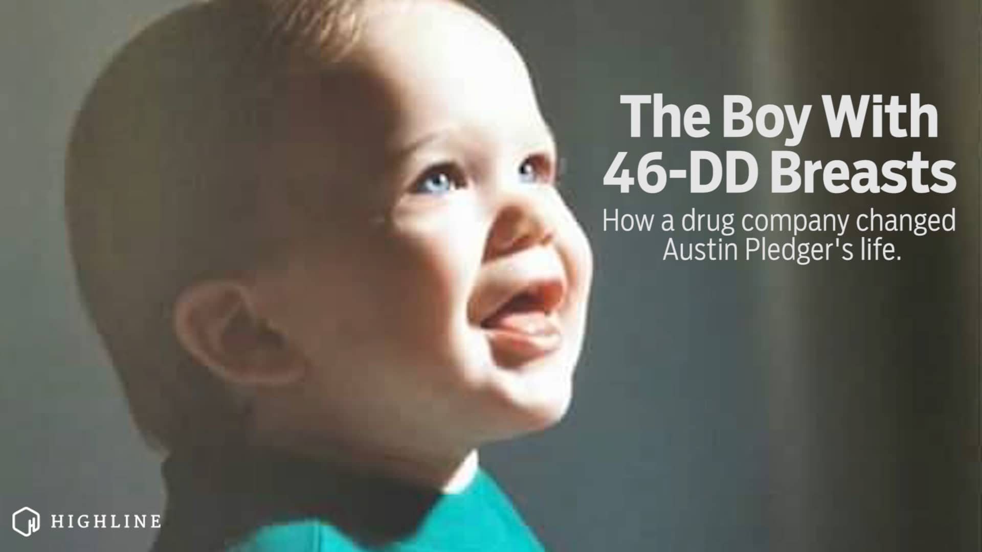 The Boy With 46-DD Breasts on Vimeo