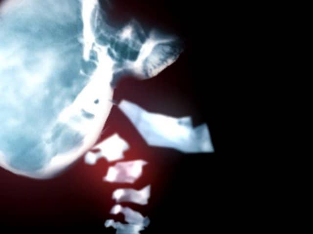 X-Ray Punch First Test on Vimeo