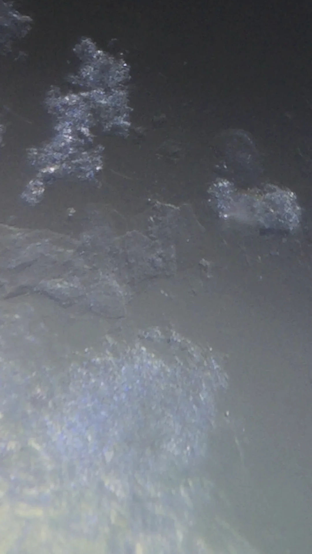 Spirochete foldscope dark field on Vimeo