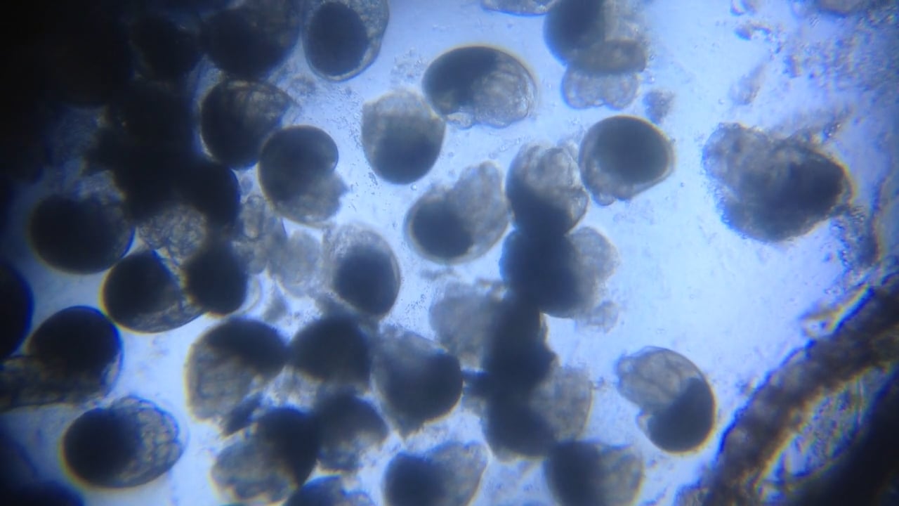 Snail Larvae 3 on Vimeo