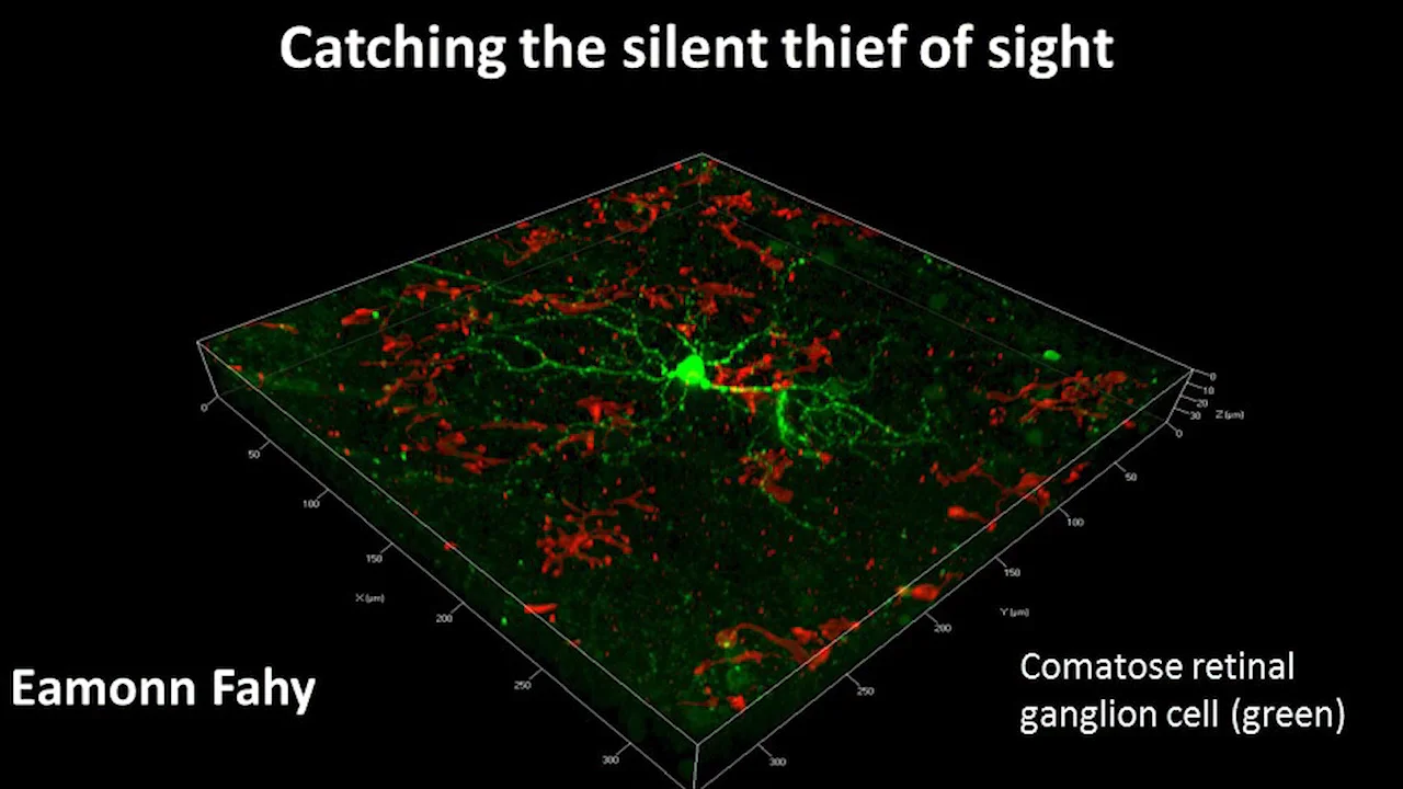 2015 Trans-Tasman 3MT Winner - Eamonn Fahy on Vimeo