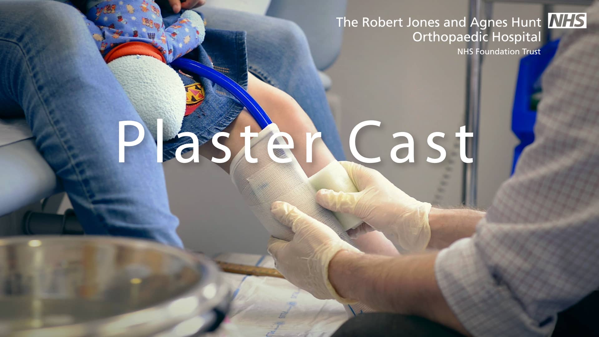 Making a plaster cast for an Ankle Foot Orthosis (AFO) on Vimeo