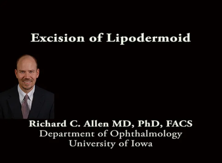 Excision of lipodermoid (dermolipoma)