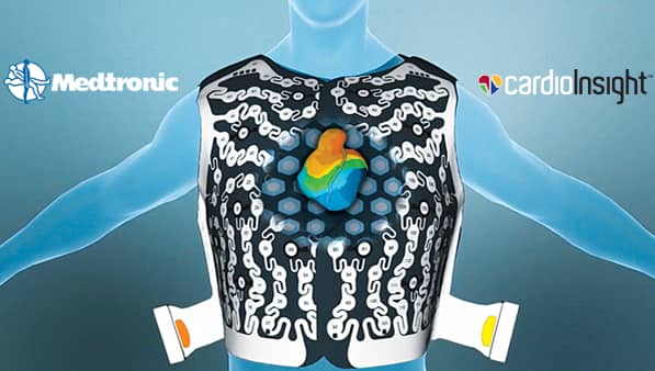 Medtronic CardioInsight: Noninvasive Dynamic Mapping in a Beat on Vimeo