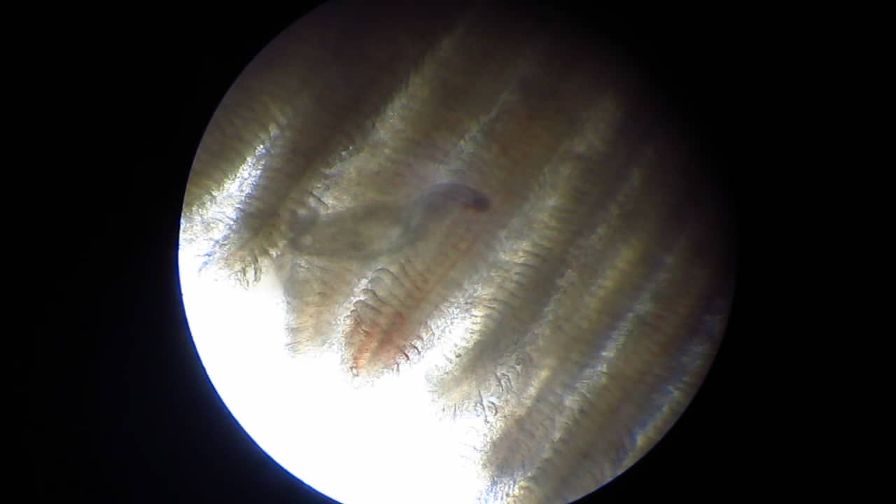 Diplectanum sp. on Vimeo