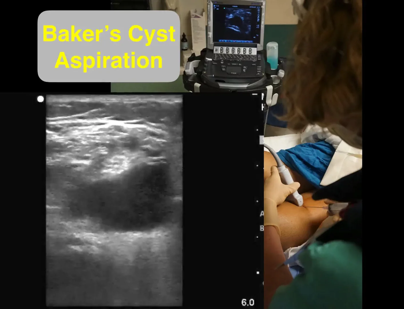 bakers aspiration panel on Vimeo