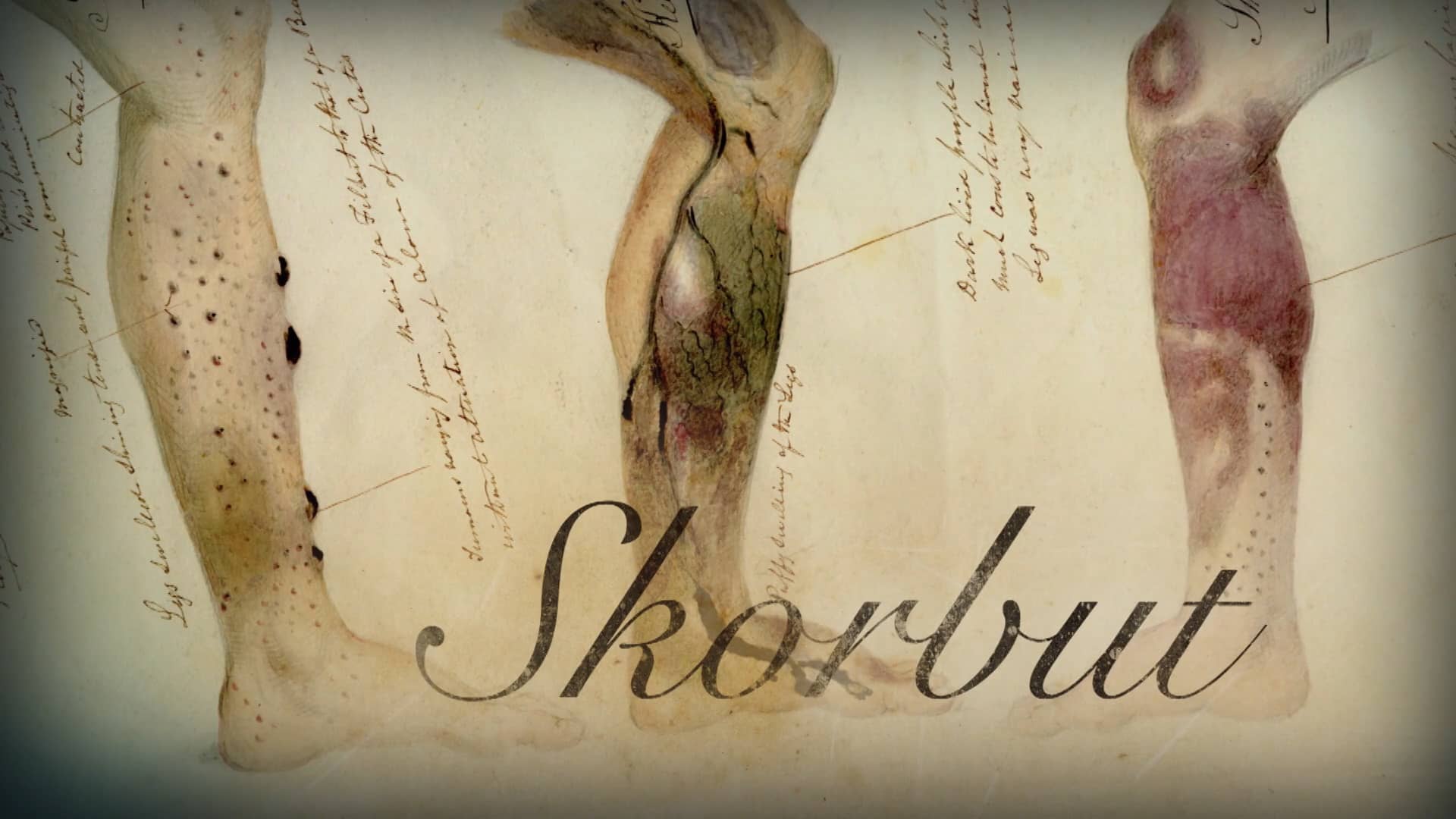 Quarks & Co "Geschichte vom Skorbut" on Vimeo