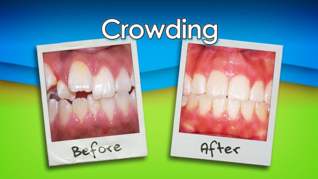 Before & After Examples on Vimeo