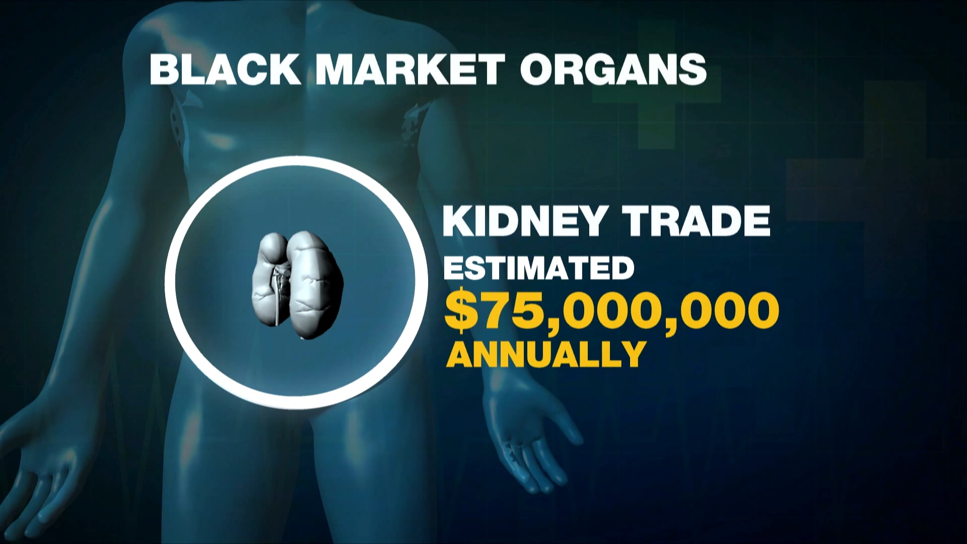 BLACK MARKET ORGAN TRADE EXPLAINER on Vimeo