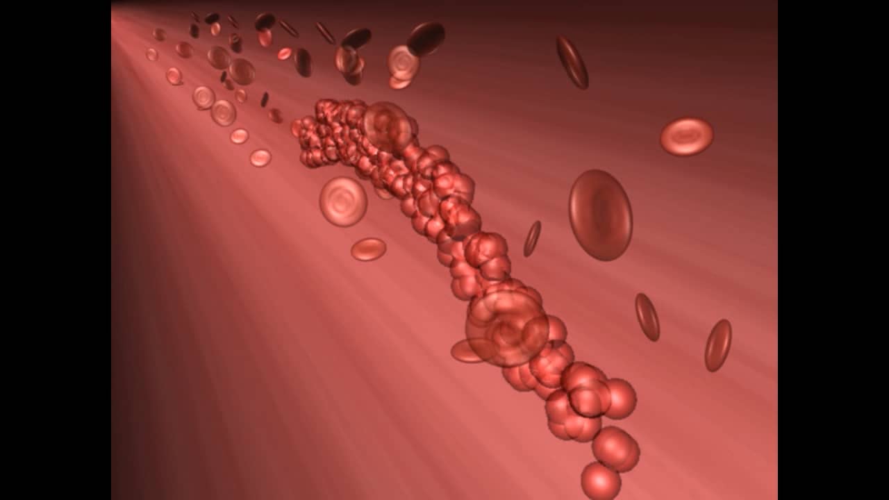 Blood Clot Animation on Vimeo