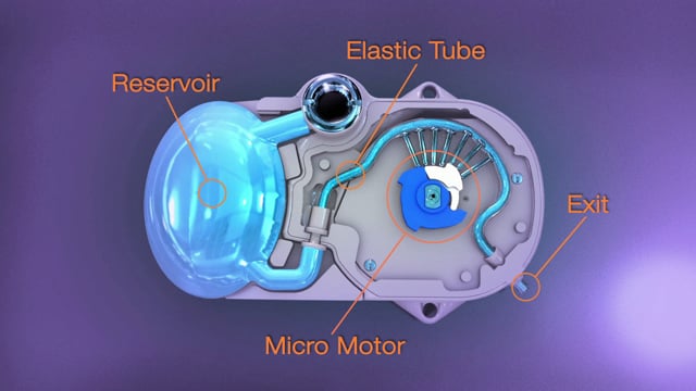 iPRECIO SMP-200 Programmable Pump in iPRECIO Programmable Pumps ...
