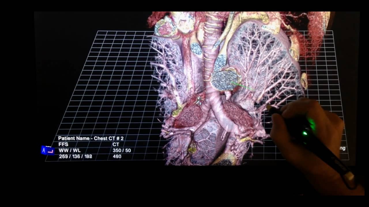 EchoPixel True 3D on Vimeo