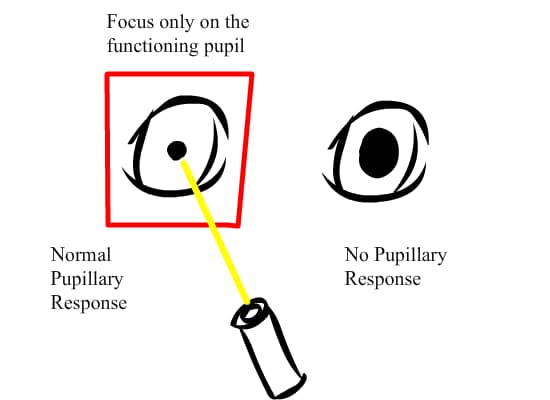 Reverse RAPD (Positive and Negative) on Vimeo