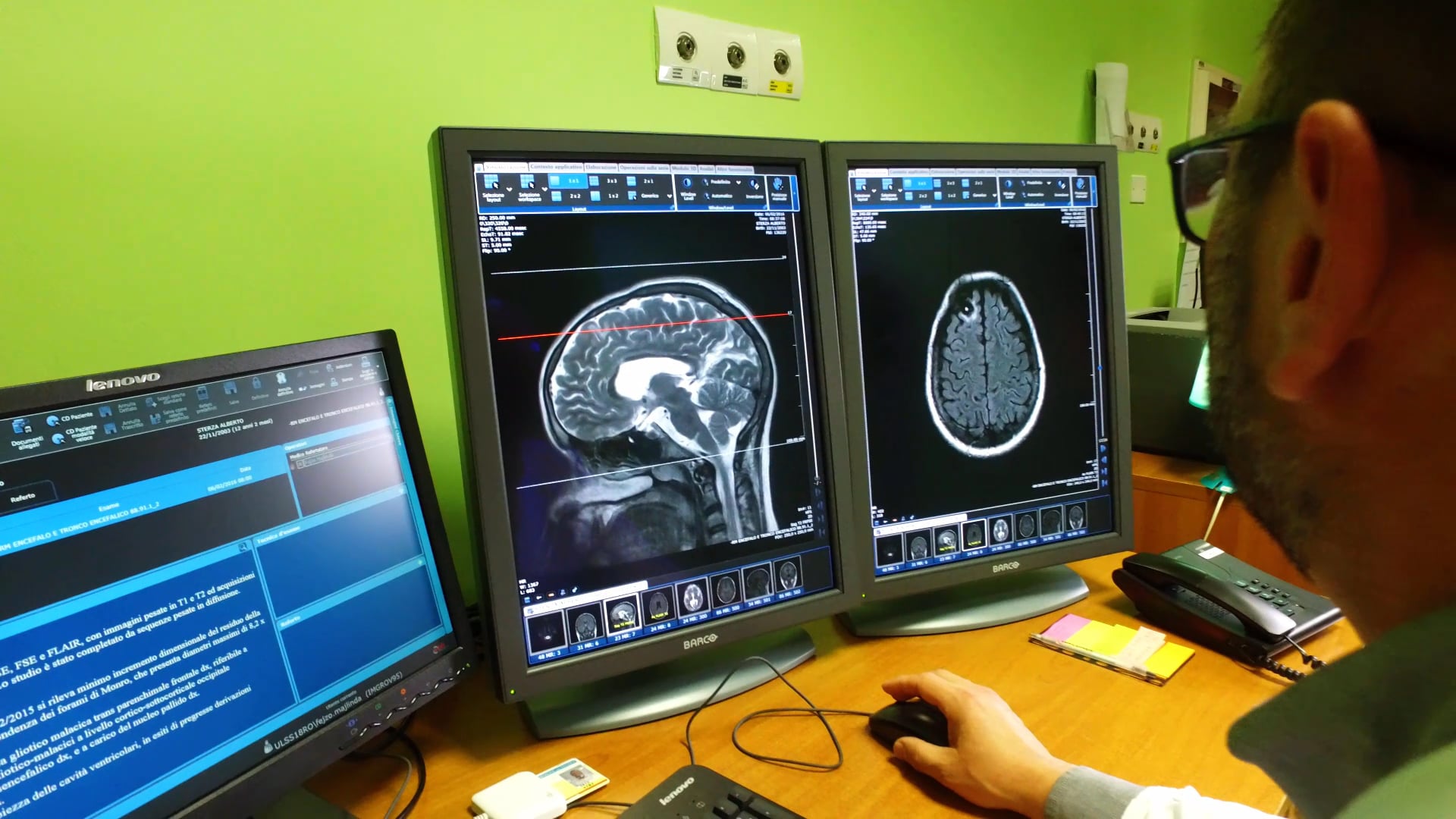 Services & Products - Hitachi Oasis Open MRI Scanner Venice (Italian ...