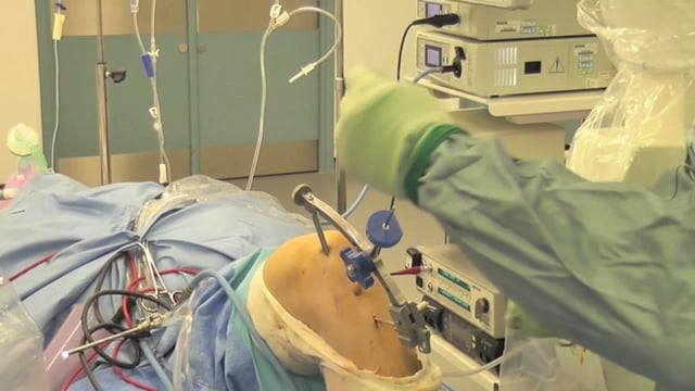 LARS™ PCL - Mr David Houlihan-Burne on Vimeo