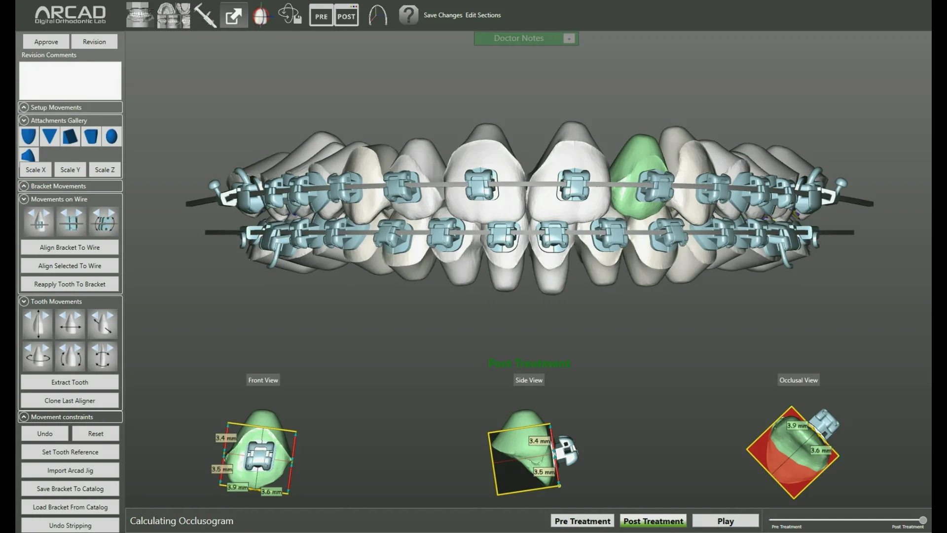 Interactive options on Vimeo