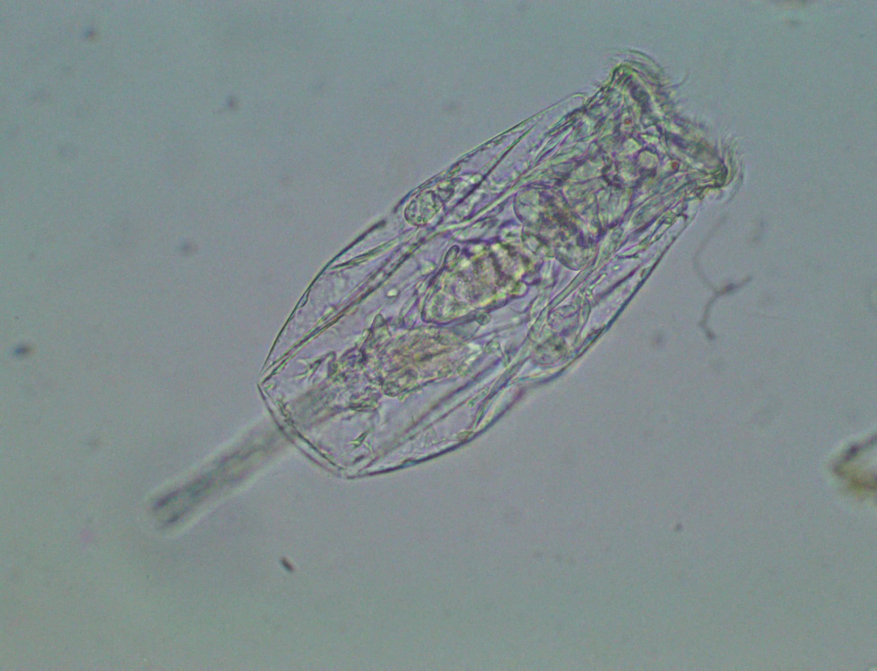 Rotifer Testudinella Good X400 T P Marsh Mid Pool 9 27 2015 (1) on Vimeo