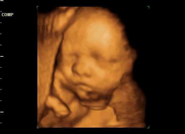 Baby Kaylen @ 28 weeks prt 2 on Vimeo