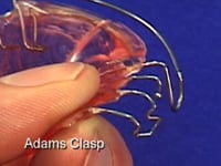 Adam's Dental Clasps, Dental Appliance Clasps | SML