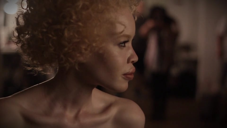 "Beyond My Skin" Campaign Short Film on Vimeo