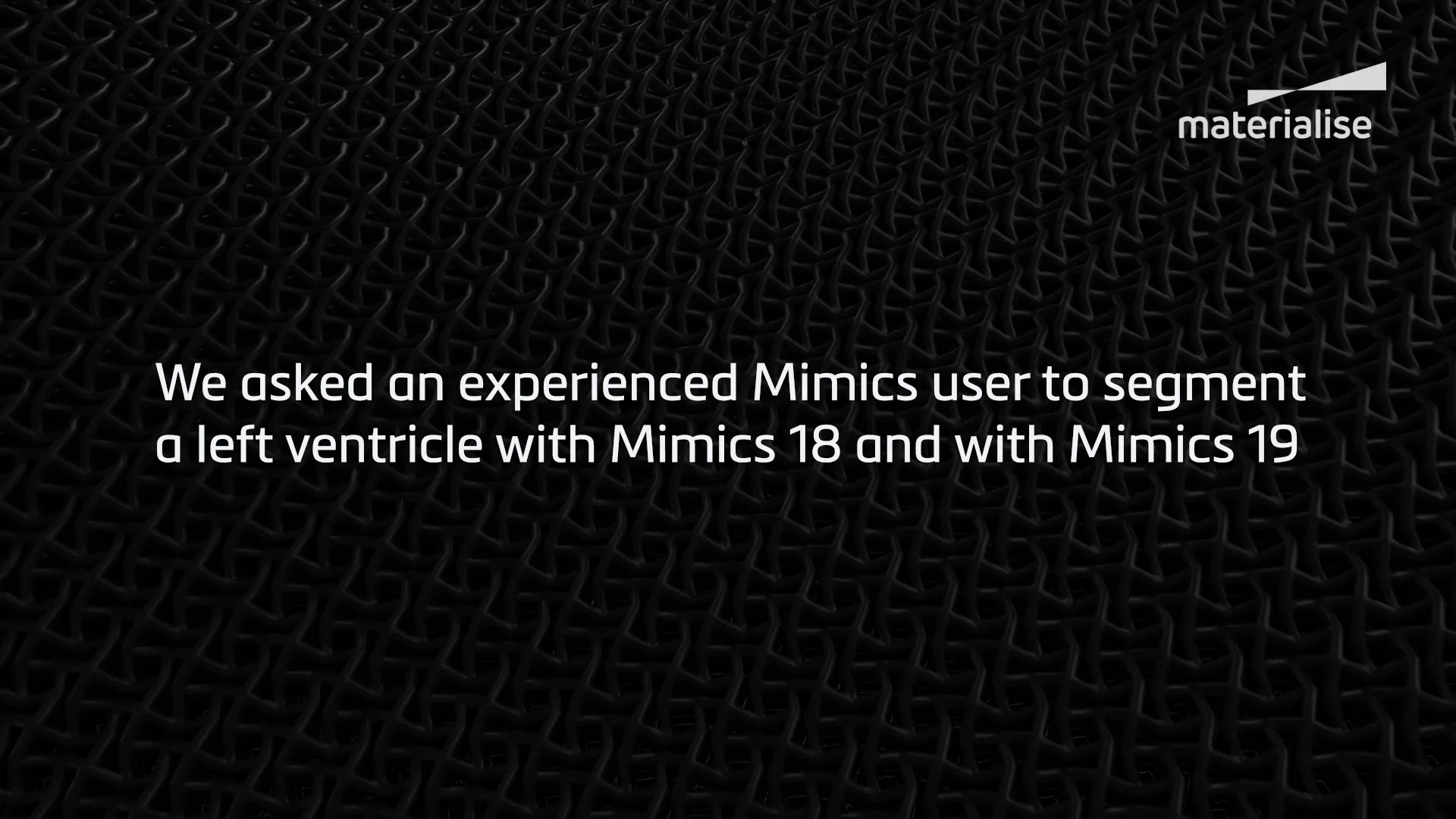 Faster segmentation in Mimics 19.0 on Vimeo