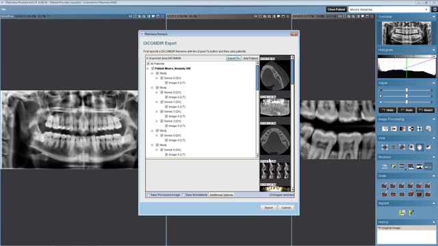 Planmeca Romexis 2D module on Vimeo