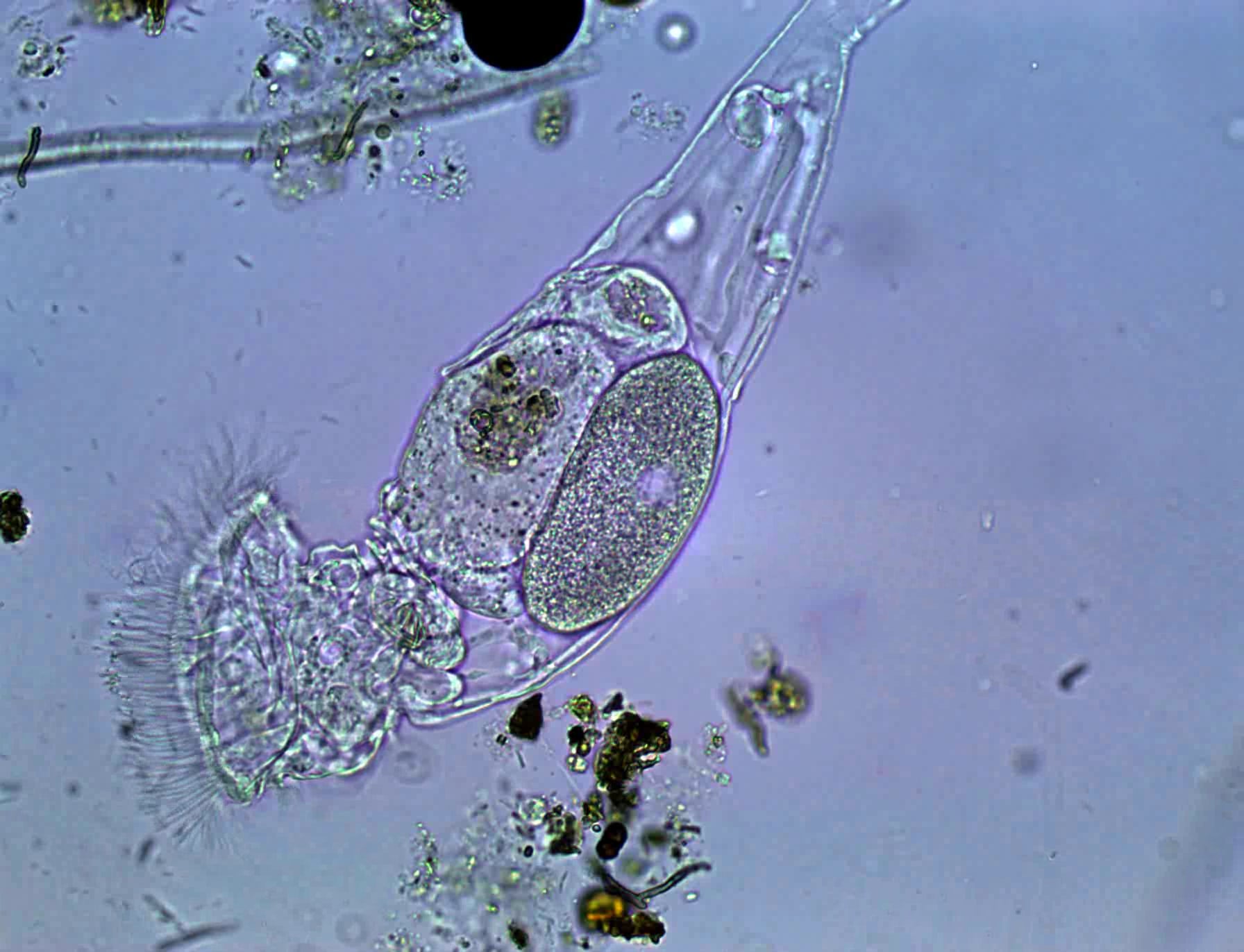 Conochilus Sub Genus Conochiloides X400 (Rotifera) Site 4 HVNC Sept ...