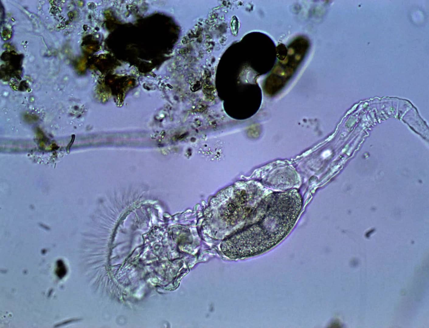 Conochilus Sub Genus Conochiloides X400 (Rotifera) Site 4 HVNC Sept ...