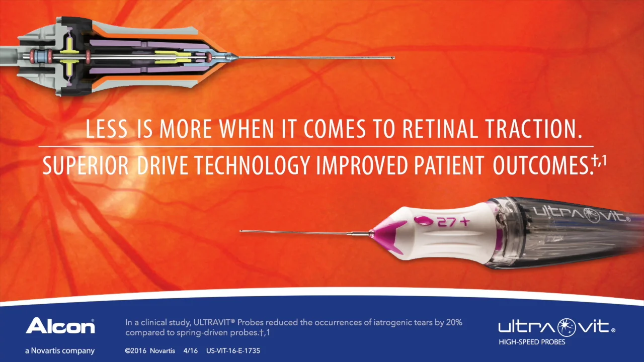 Alcon ultravit on Vimeo