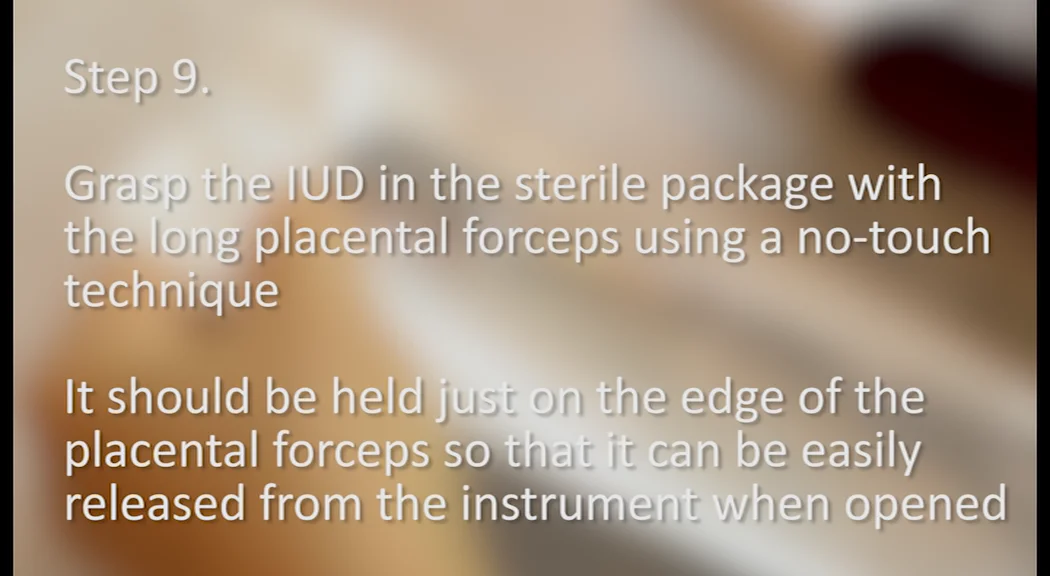 3. Video of immediate PPIUD insertion