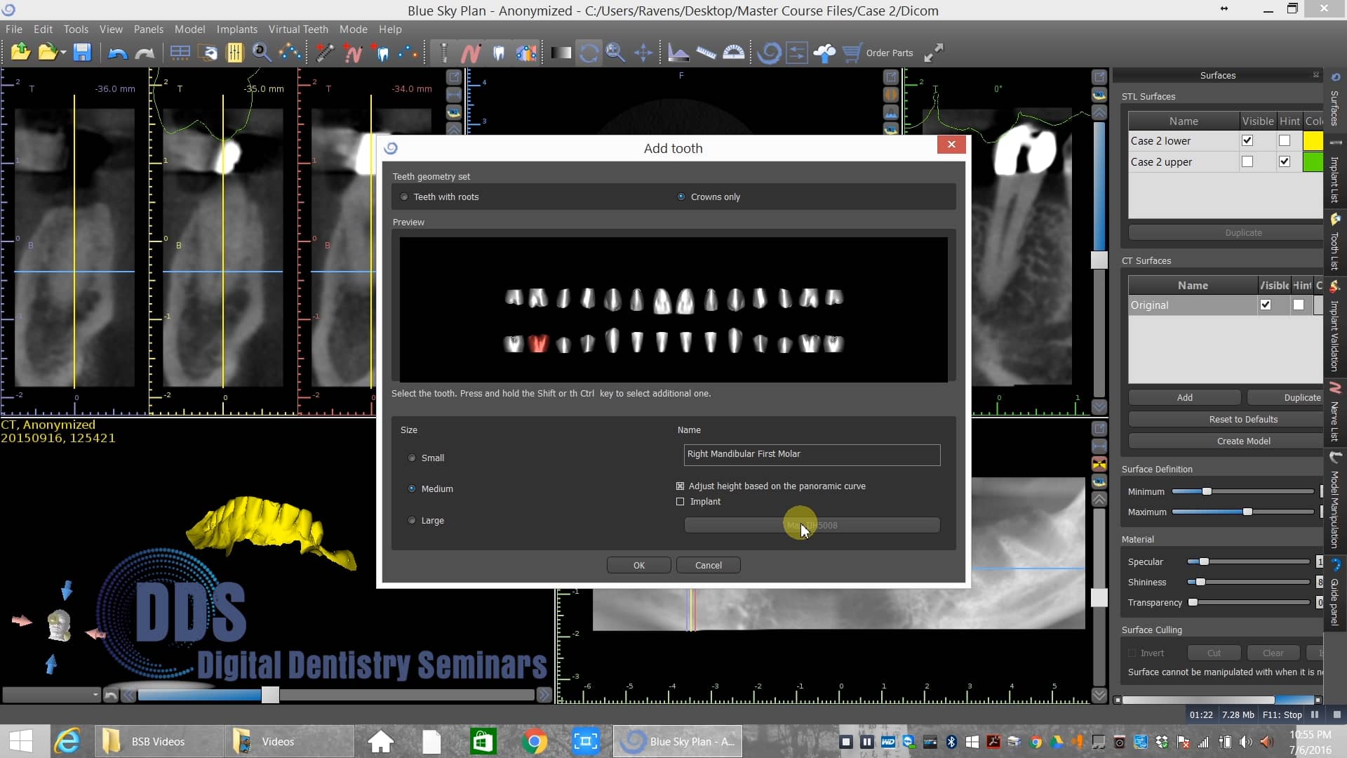Blue Sky Bio - Virtual Wax Up on Vimeo