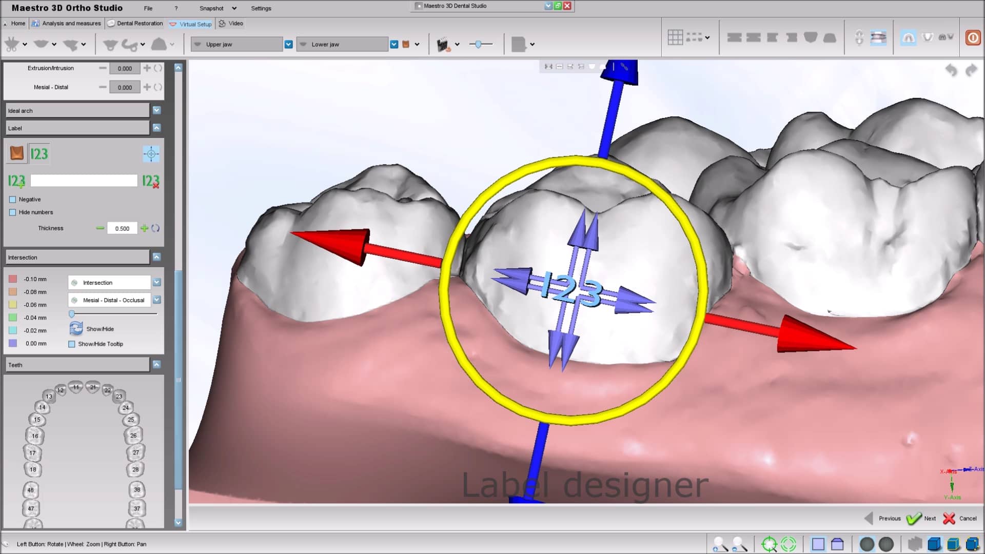 Maestro3D Dental Studio 2016 on Vimeo