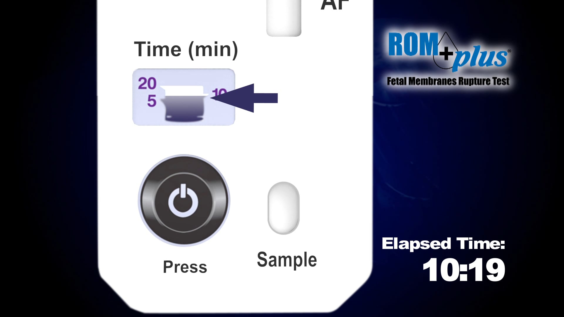 ROM Plus Video B - Quality Control Procedure on Vimeo