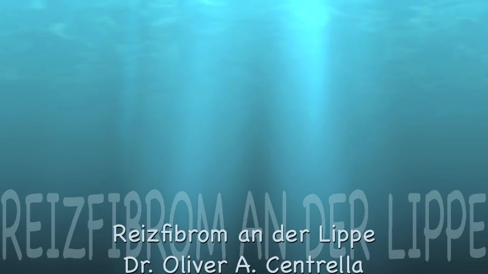 Reizfibrom Lippe on Vimeo