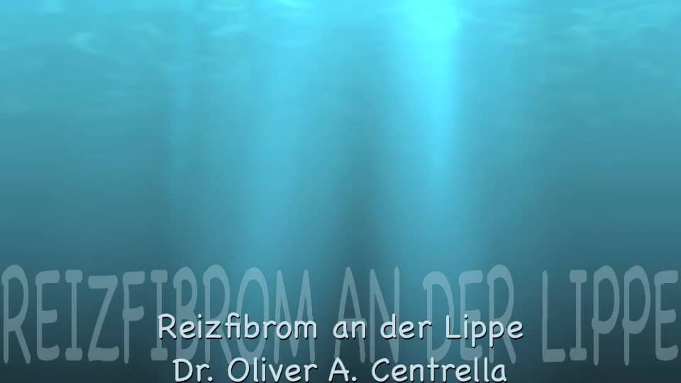Reizfibrom Lippe on Vimeo