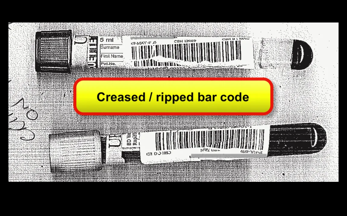 Collecting a specimen