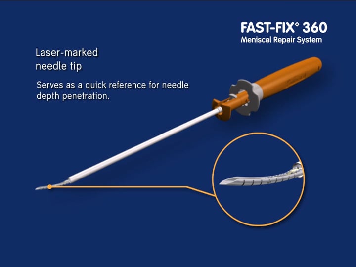 RESUMEN ANIMADO DEL SISTEMA FAST-FIX 360 on Vimeo