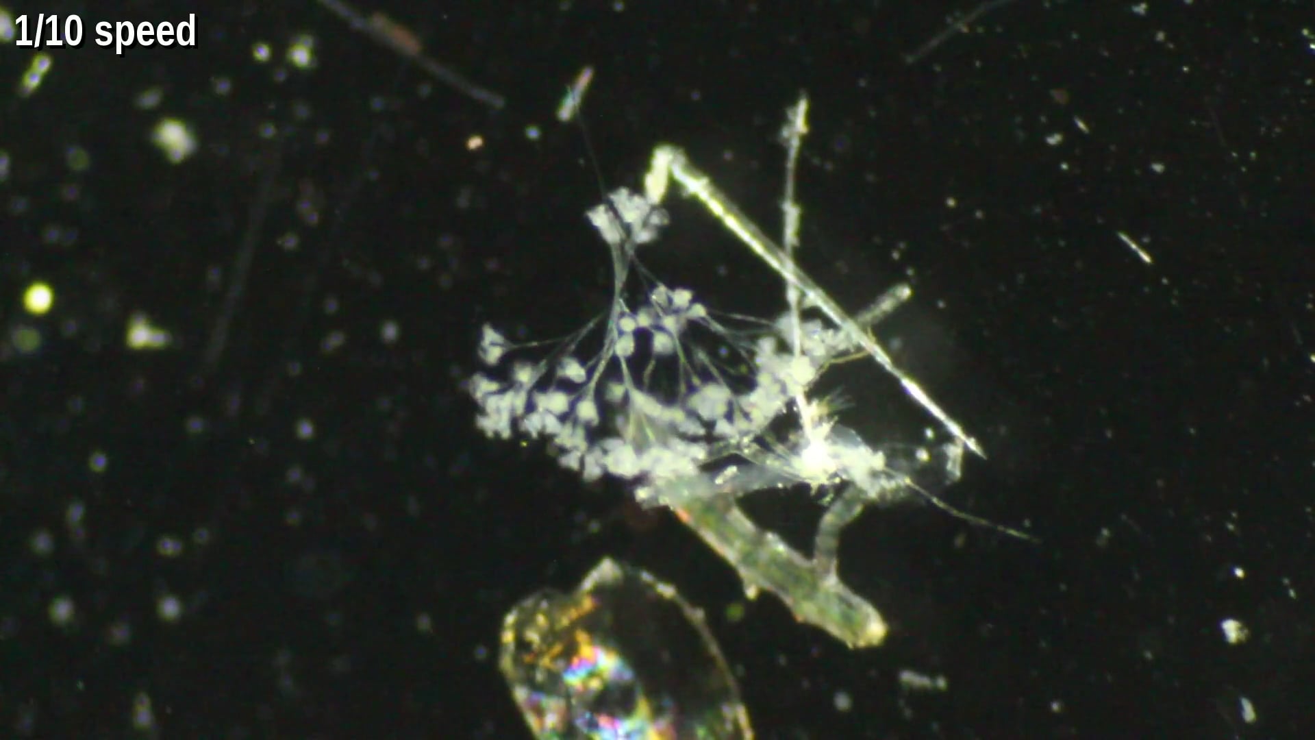 Contraction of a colonial ciliate on Vimeo