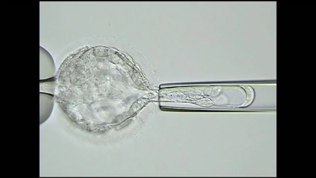 T-biopsy (BIOPSIA DE TROFOECTODERMO)