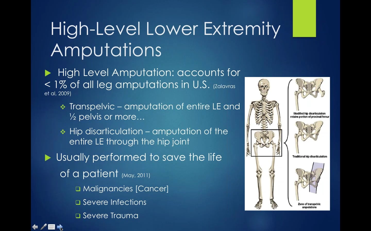 High-Level Lower Limb Amputation on Vimeo