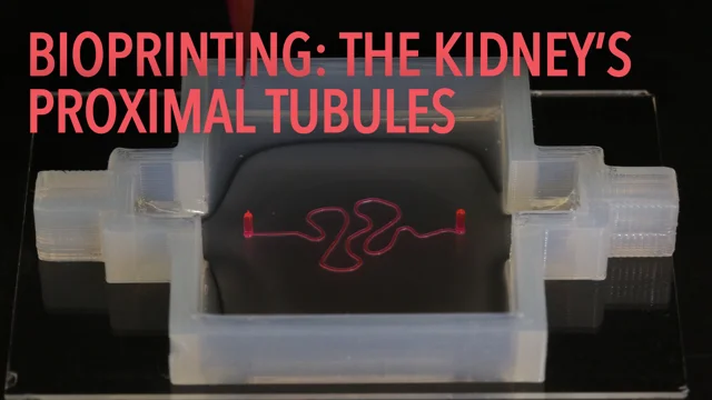 3d Printed Kidney
