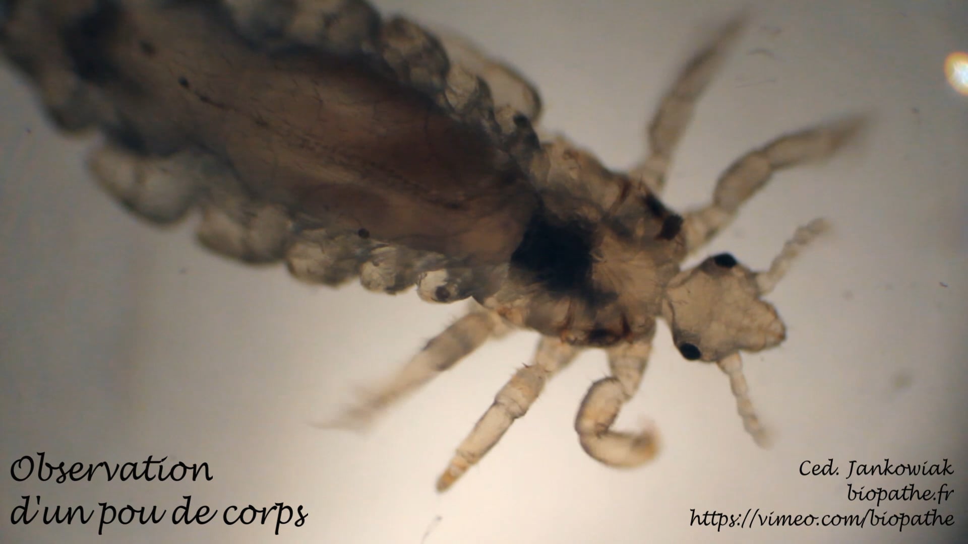 Observation de poux vivants au microscope