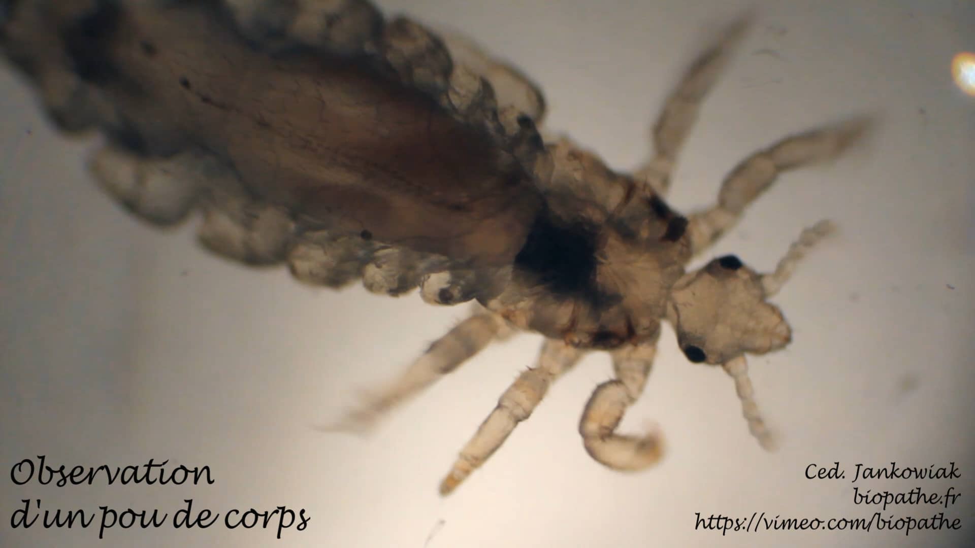 Observation de poux vivants au microscope on Vimeo
